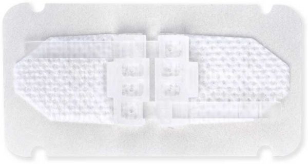 DermaClip & DermaQuik - Non-Invasive Skin Closure