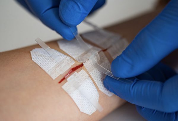 DermaClip & DermaQuik - Non-Invasive Skin Closure