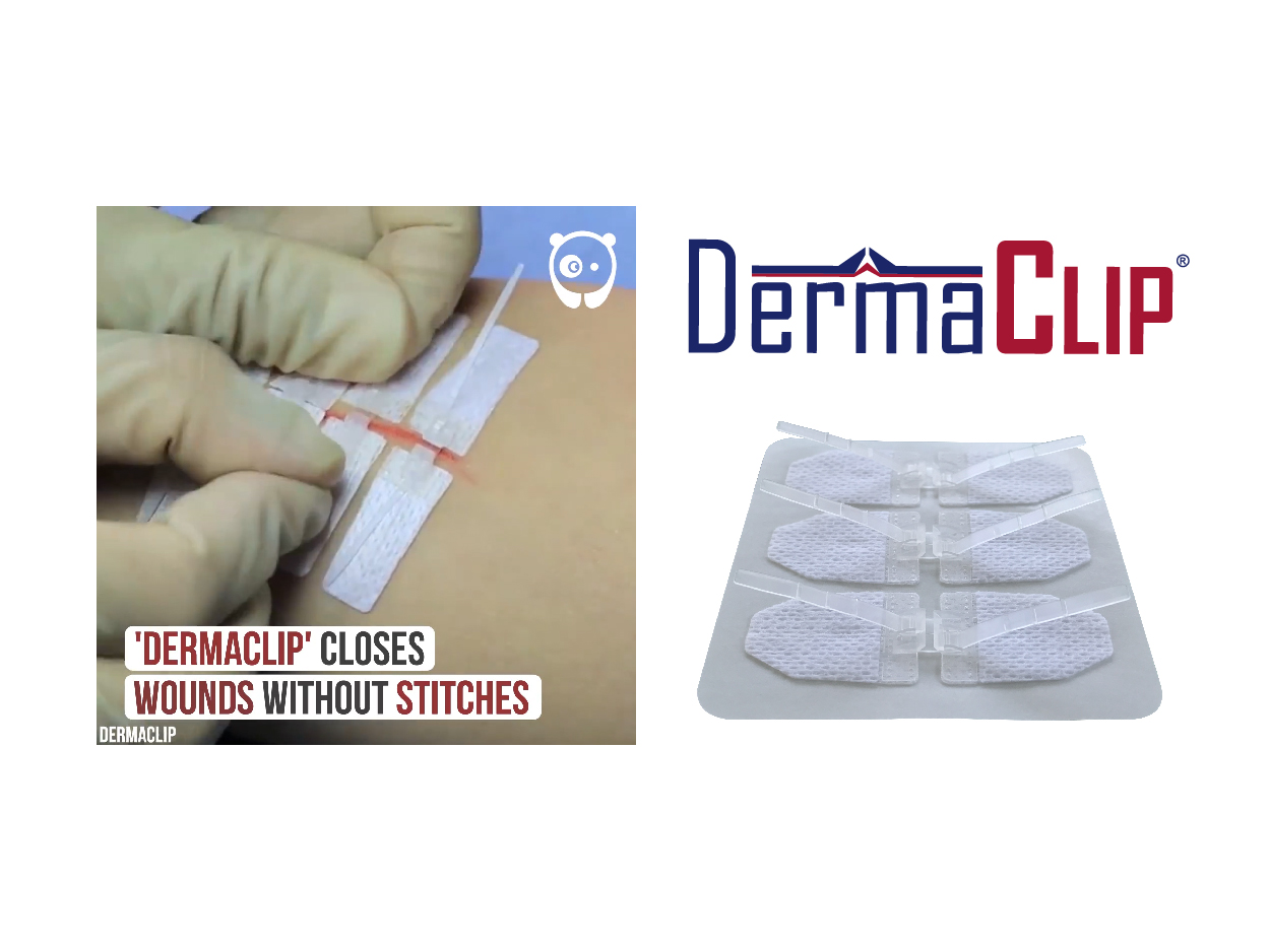 DermaClip Featured on Bored Panda - DermaClip