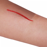 DermaClip - Instructions for Use