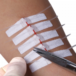 DermaClip - Instructions for Use