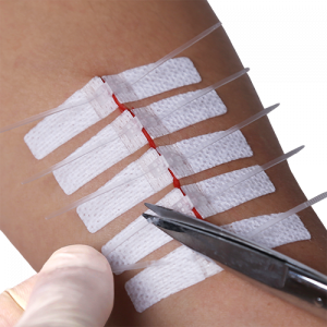 DermaClip - Instructions for Use