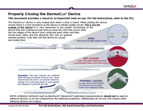 DermaClip - Instructions for Use