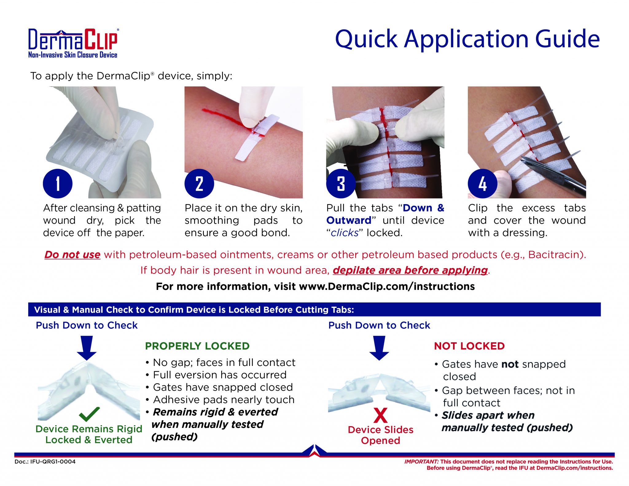 DermaClip - Instructions for Use