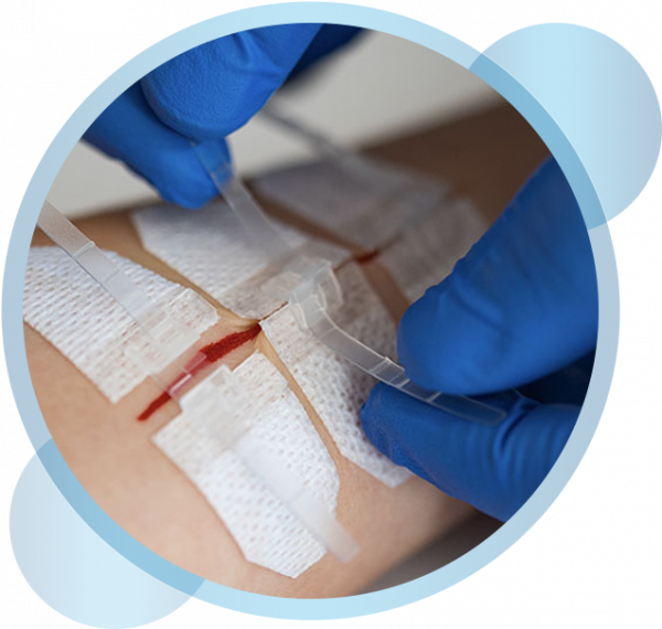 DERMACLIP - DermaClip