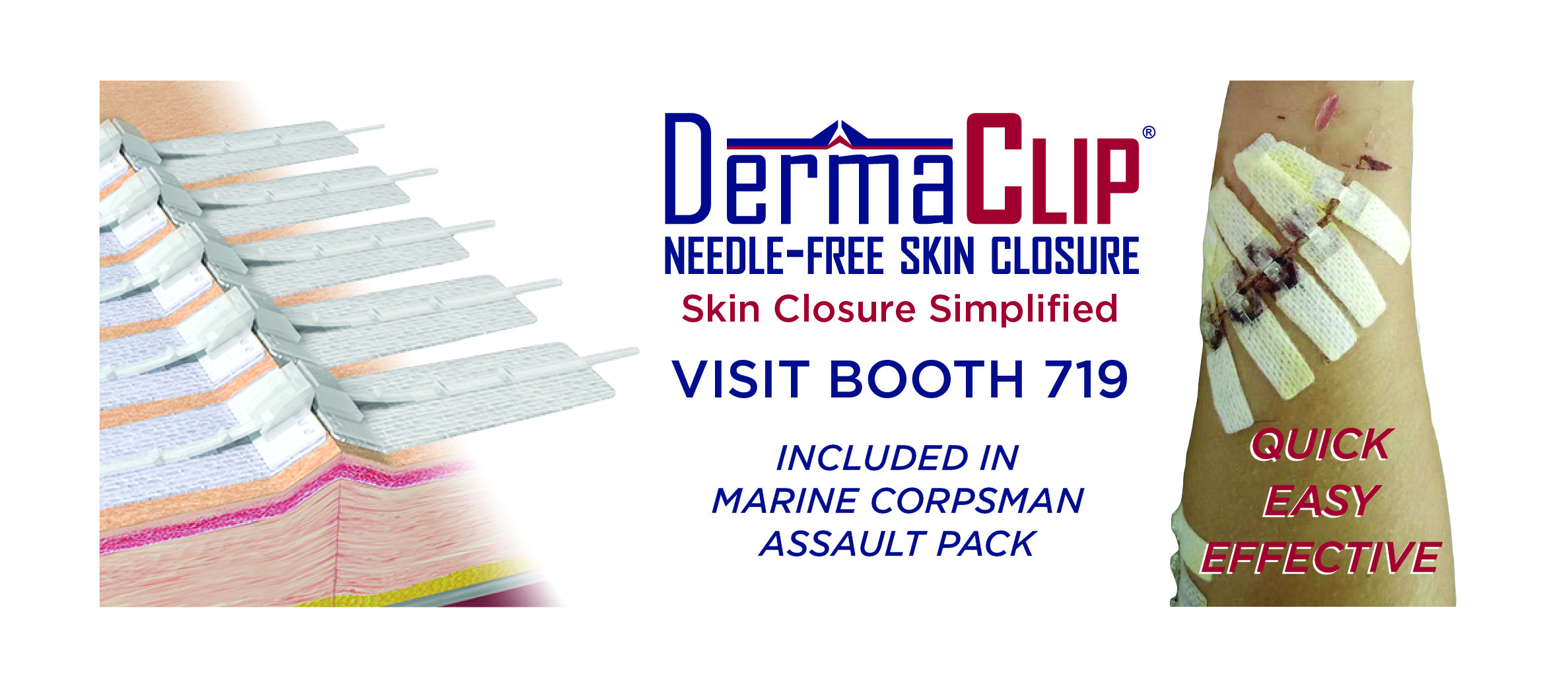 DermaClip Heads to SOMA 2025: Changing the Game in Tactical Wound Closure - DermaClip